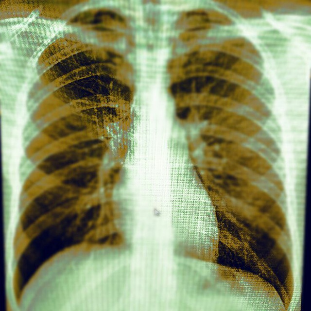 Telegram group "Radiology/Рентгенология Чат" — @radiologyMMAchat statistics — TGStat